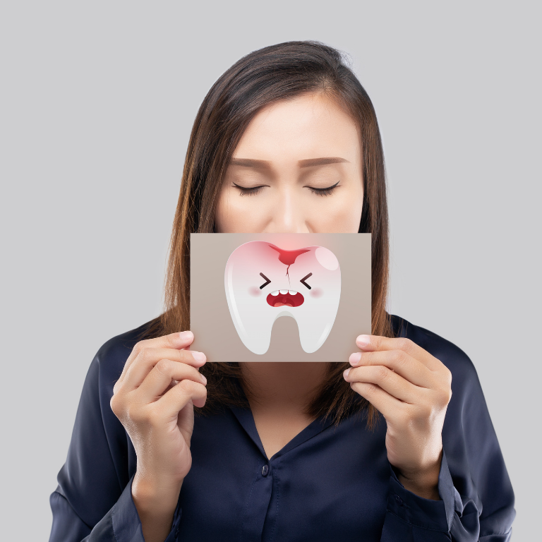 Causes of Tooth Decay - Dekodent